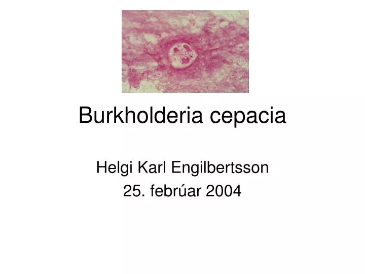 PPT - Burkholderia cepacia PowerPoint Presentation, free download - ID ...