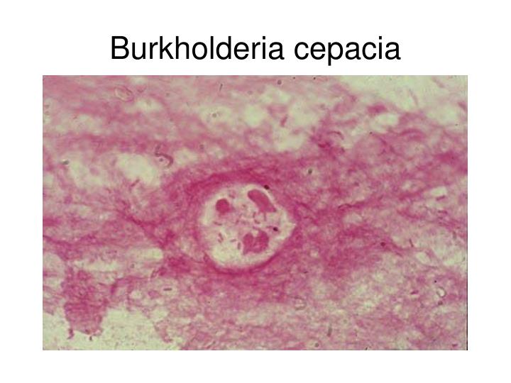 PPT - Burkholderia cepacia PowerPoint Presentation - ID:4198630