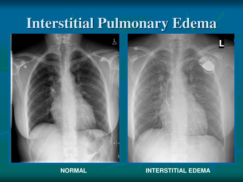 PPT Back To Basics Radiology 2010 PowerPoint Presentation Free