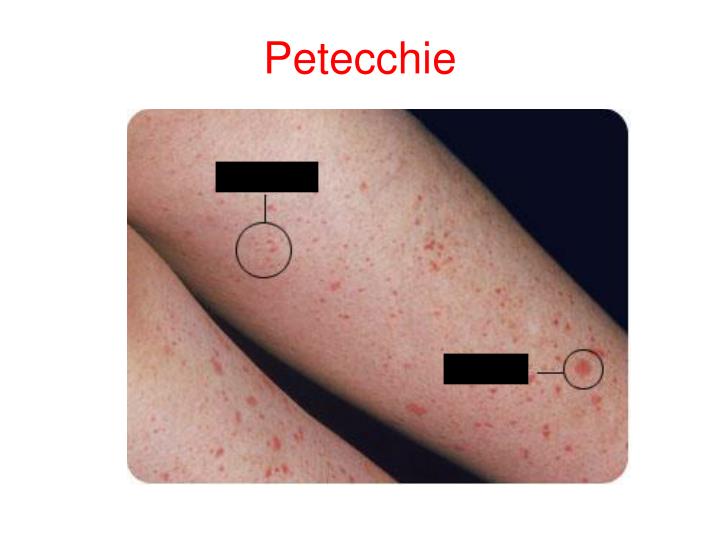 PPT - Fisiopatologia dell’emostasi: la cascata e dintorni PowerPoint ...