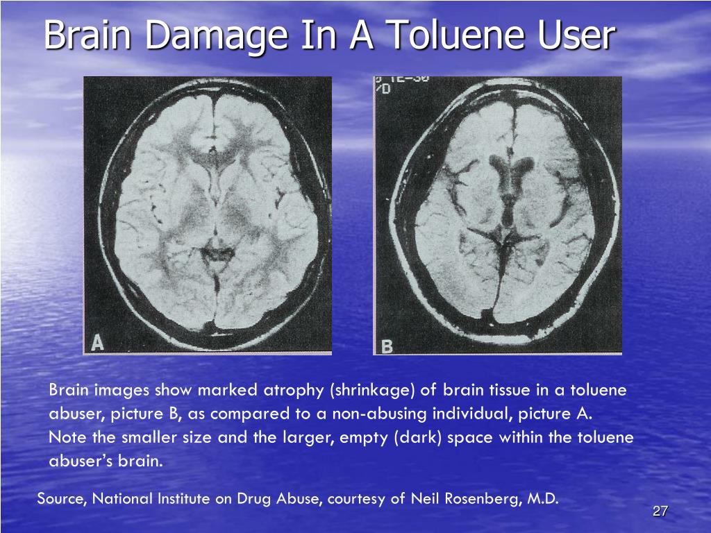 PPT - New England Inhalant Abuse Prevention Coalition PowerPoint ...