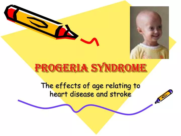 PPT - Progeria Syndrome PowerPoint Presentation, free download - ID:4203829