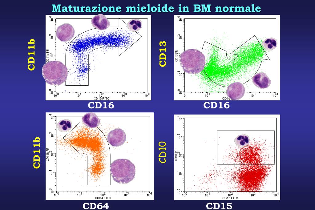 PPT - L’immunofenotipo leucocitario: utilità diagnostica PowerPoint ...