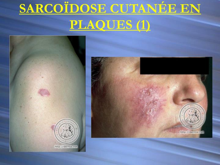 PPT - CAS CLINIQUE PowerPoint Presentation - ID:4203909