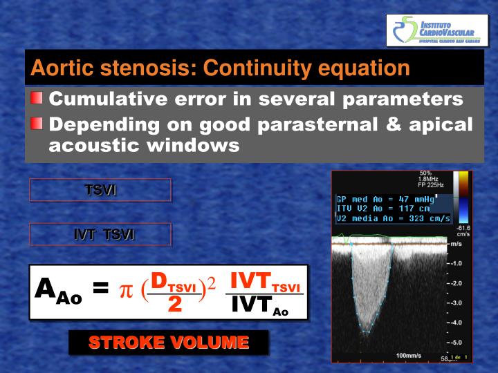 PPT - Three-dimensional echocardiography in the clinical world ...