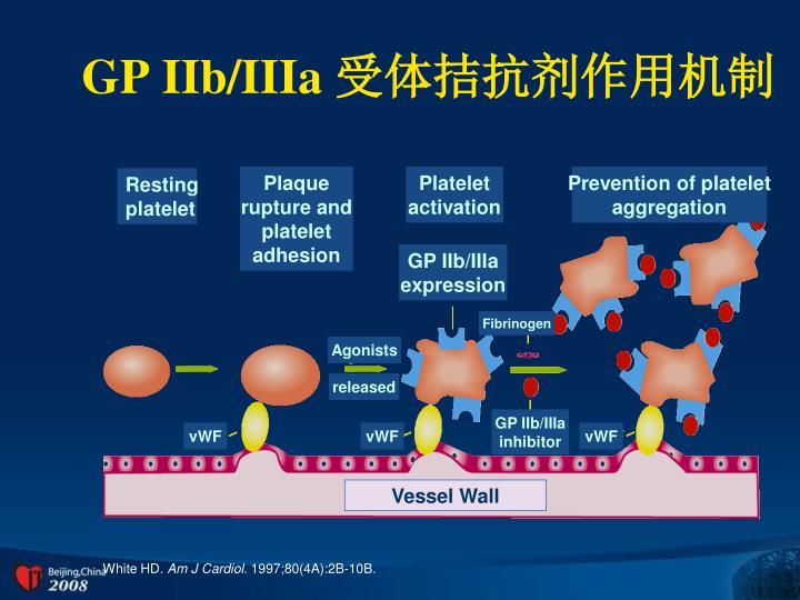 PPT - 那些病人能从 GP IIb/IIIa Inhibitors 获益 PowerPoint Presentation - ID:4204707