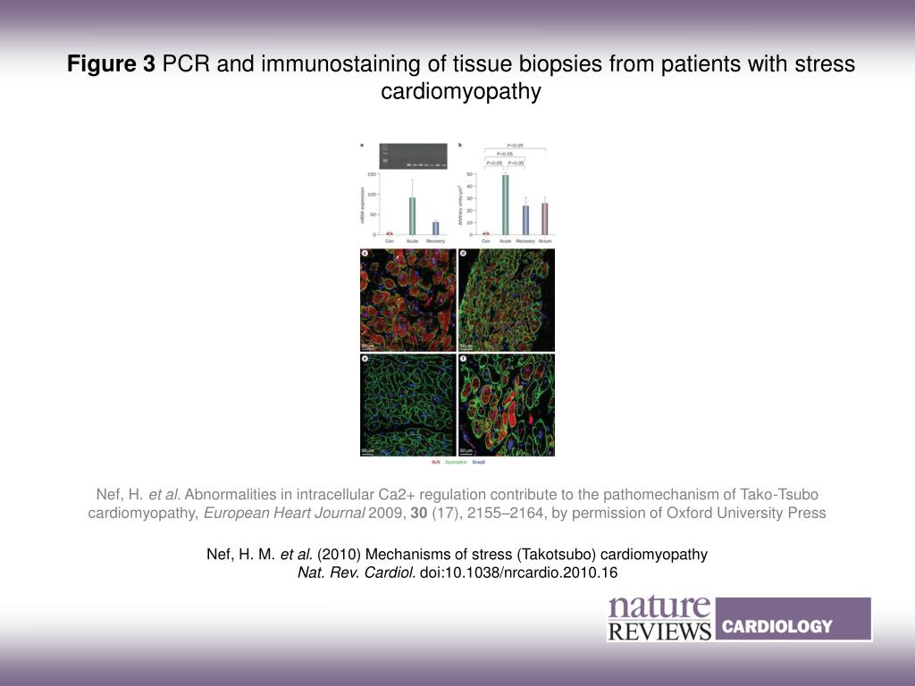 PPT - Figure 3 PCR and immunostaining of tissue biopsies from patients ...