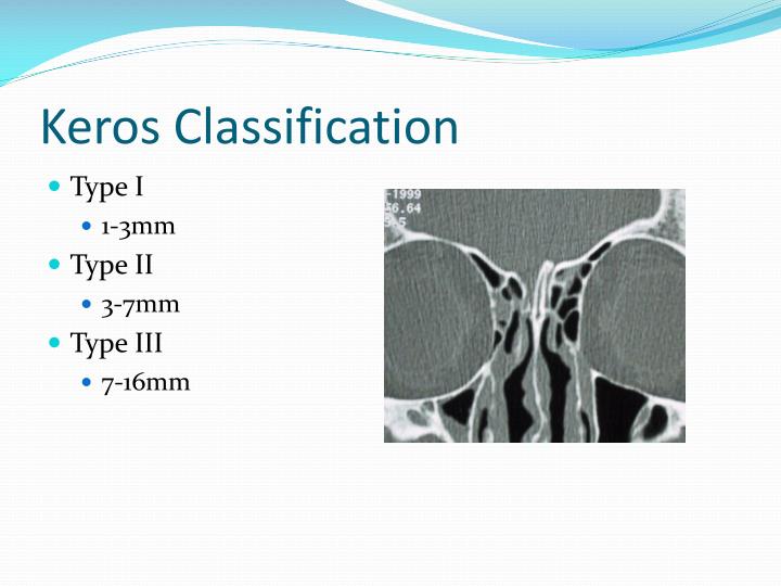 PPT - Principles of Functional Endoscopic Sinus Surgery PowerPoint ...