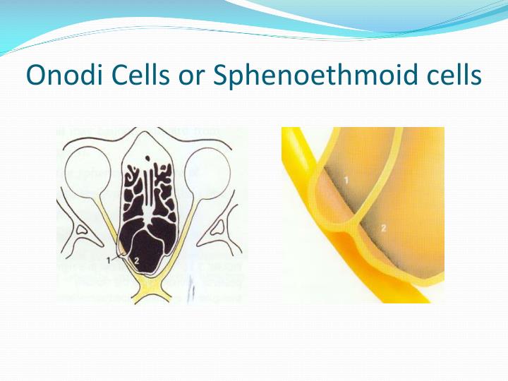 PPT - Principles of Functional Endoscopic Sinus Surgery PowerPoint ...