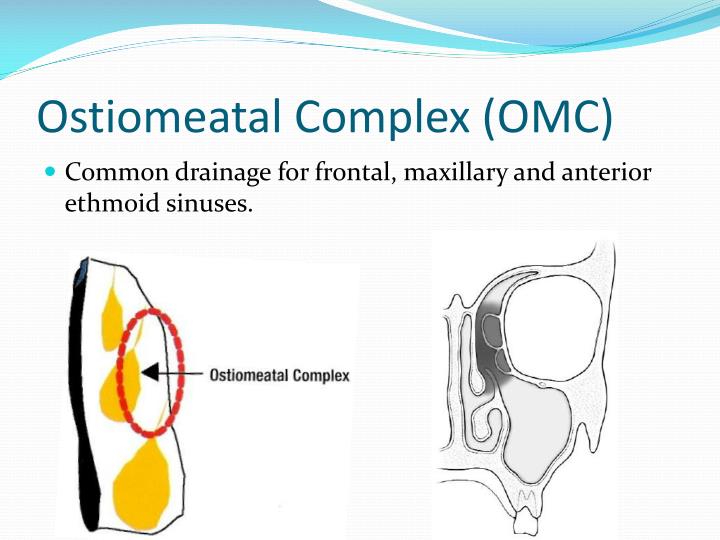 PPT - Principles of Functional Endoscopic Sinus Surgery PowerPoint ...