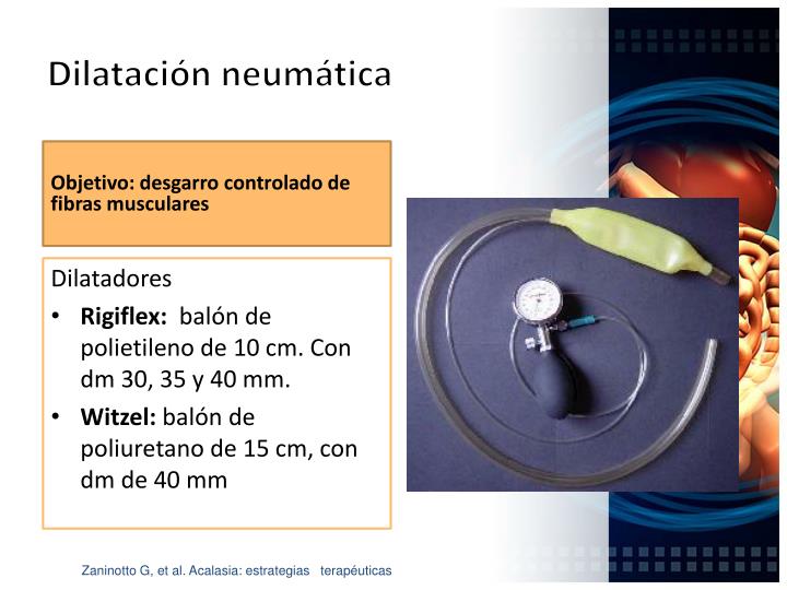 PPT - ACALASIA PowerPoint Presentation - ID:4211948