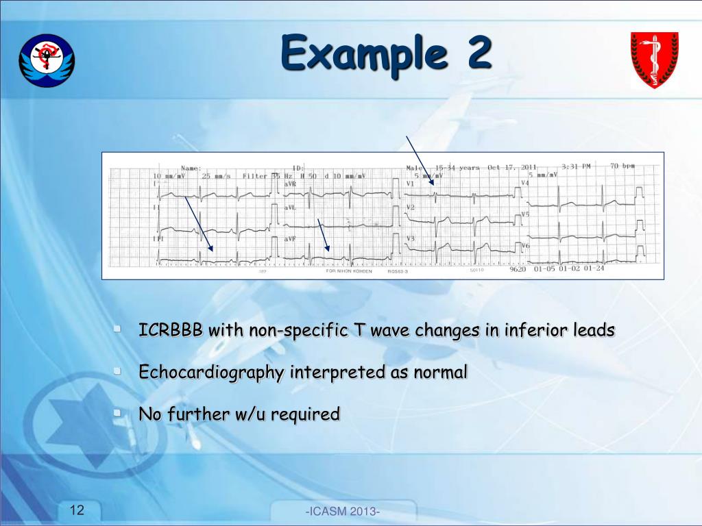 PPT - Pre-participation ECG screening in military recruits- the IDF ...