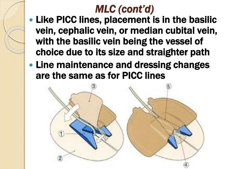 PPT - LPN-C PowerPoint Presentation - ID:4215274