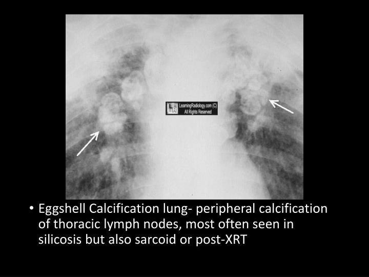 PPT - Battle of the Brains PowerPoint Presentation - ID:4218403