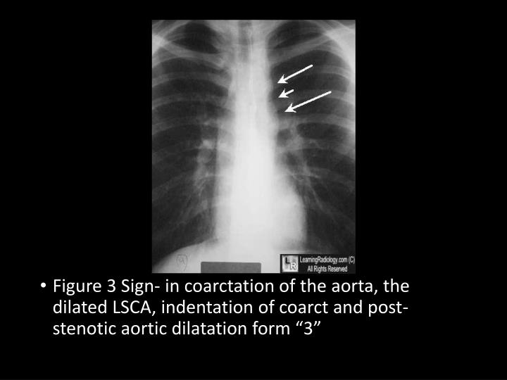 PPT - Battle of the Brains PowerPoint Presentation - ID:4218403