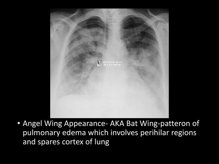 PPT - Battle of the Brains PowerPoint Presentation - ID:4218403