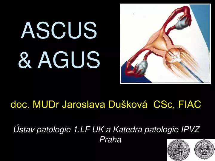 PPT - ASCUS & AGUS PowerPoint Presentation, free download - ID:4219658