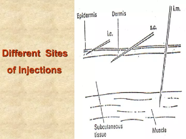 PPT - Different Sites of Injections PowerPoint Presentation, free ...