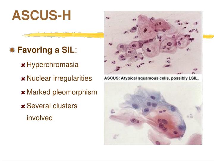 PPT - Cervical Cancer Screening… An Overview PowerPoint Presentation ...