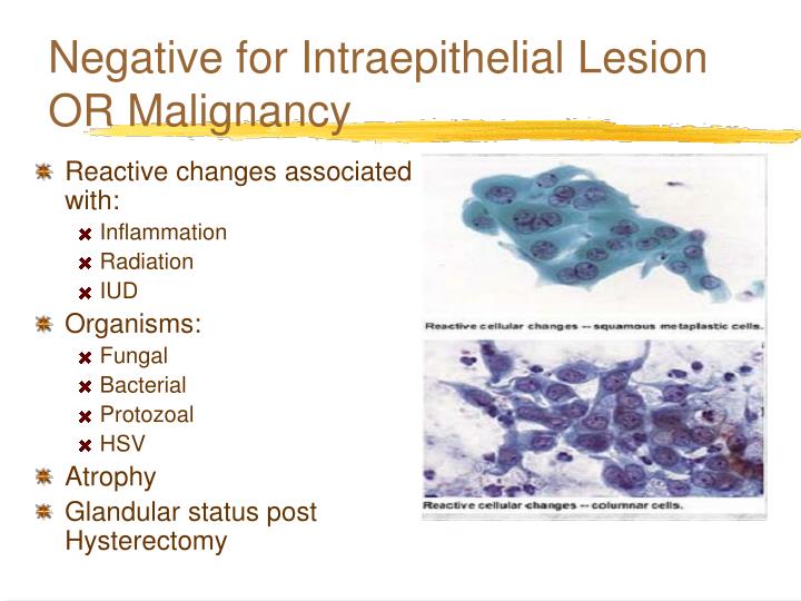 PPT - Cervical Cancer Screening… An Overview PowerPoint Presentation ...
