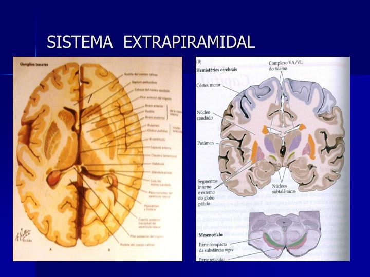 PPT - SÍNDROMES MOTORAS PIRAMIDAL E EXTRAPIRAMIDAL PowerPoint ...