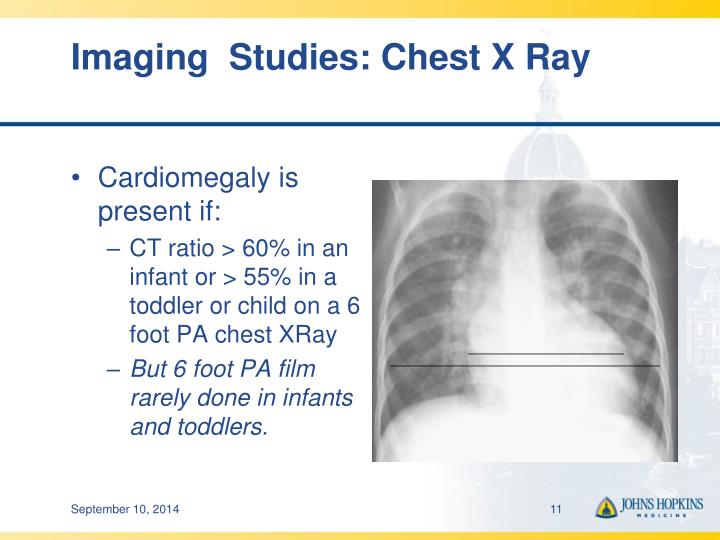 PPT - THE CARDIOVASCULAR SYSTEM IN CHILDHOOD PowerPoint Presentation ...