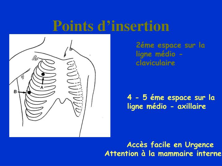 PPT - Détresse Respiratoire Aiguë PowerPoint Presentation - ID:4231938