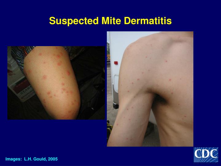 PPT - Biology of Ticks and Mites PowerPoint Presentation - ID:4236108