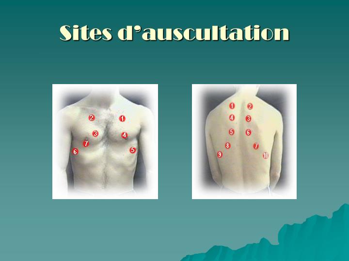 PPT - AUSCULTATION PULMONAIRE Mélissa Viau inf. PowerPoint Presentation ...