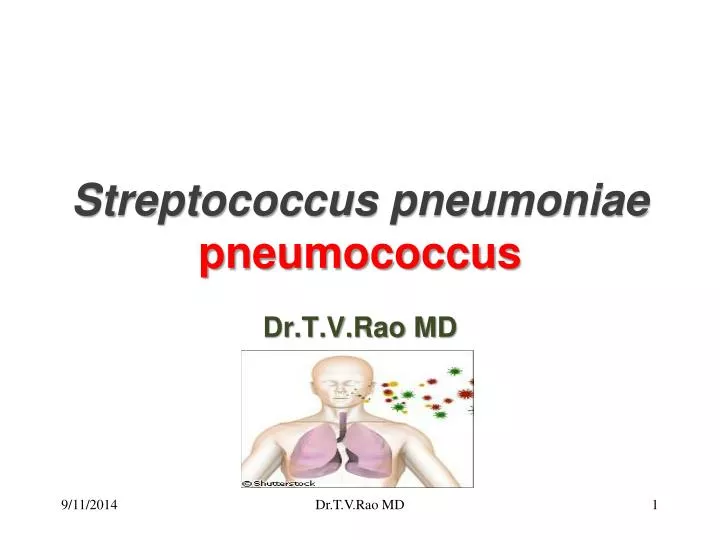 PPT - Streptococcus pneumoniae pneumococcus PowerPoint Presentation ...