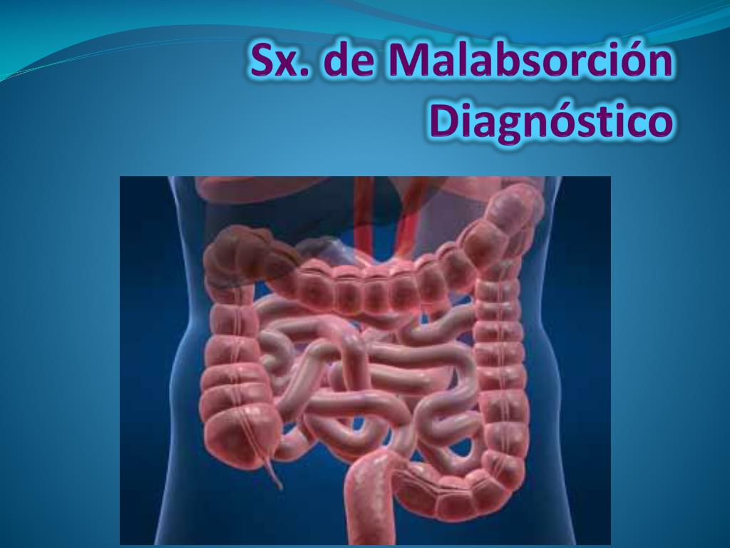 PPT - Síndrome de mala absorción PowerPoint Presentation, free download ...