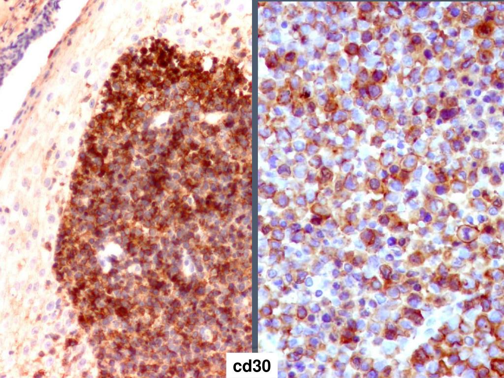 PPT - Service d’Anatomie Pathologique Hôpital Abderrahmen Mami Ariana ...
