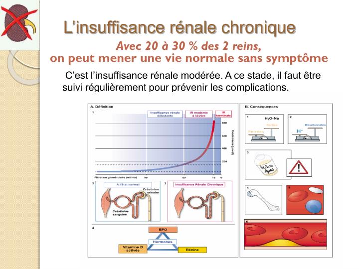 PPT - Fonction et maladie du rein vers l’insuffisance rénale PowerPoint ...