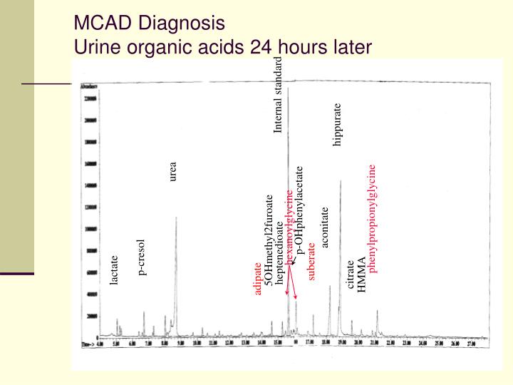 PPT - Newborn screening for MCADD PowerPoint Presentation - ID:4250360