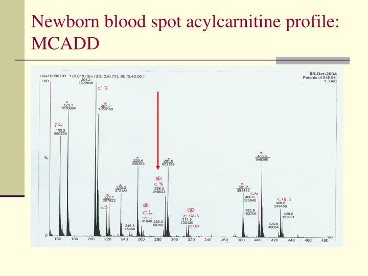 PPT - Newborn screening for MCADD PowerPoint Presentation - ID:4250360