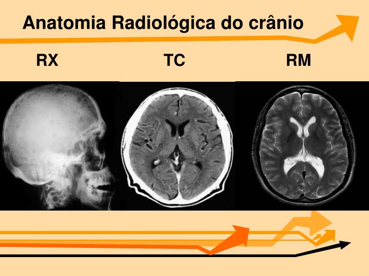 PPT - ANATOMIA RADIOLÓGICA PowerPoint Presentation - ID:4266551