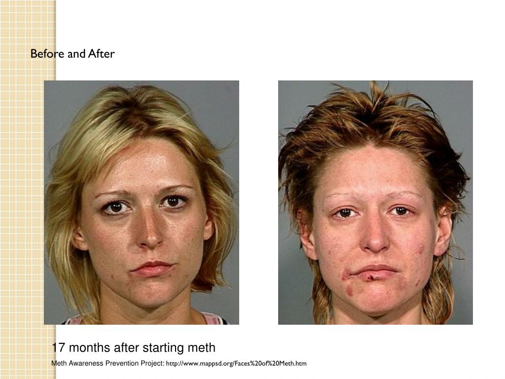 PPT - Individual Drug Info PowerPoint Presentation, free download - ID ...