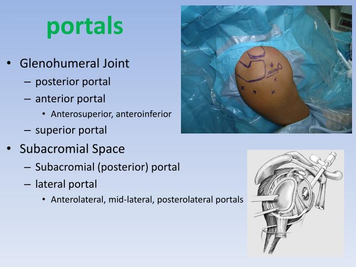 PPT - Shoulder arthroscopy PowerPoint Presentation - ID:4270378
