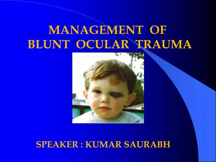 PPT - MANAGEMENT OF BLUNT OCULAR TRAUMA PowerPoint Presentation, free ...