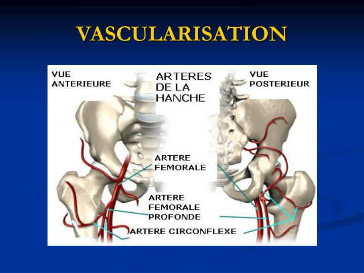 PPT - FRACTURES DE L’EXTREMITE SUPERIEURE DU FEMUR PowerPoint ...