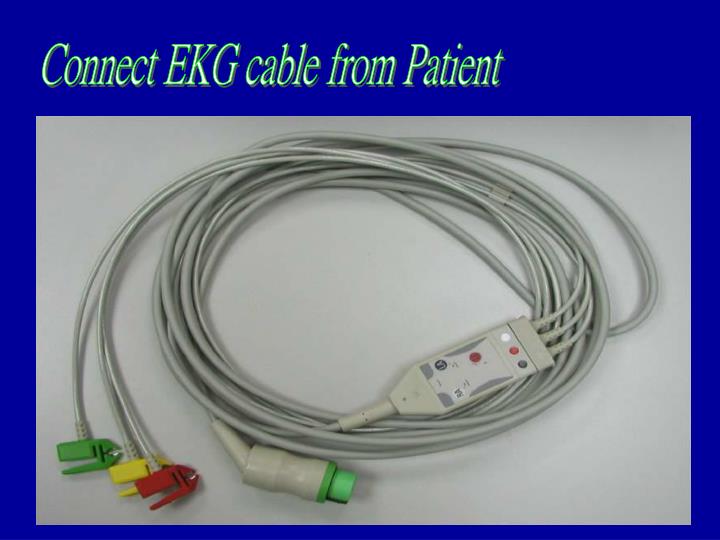 PPT - IABP PowerPoint Presentation - ID:4280487