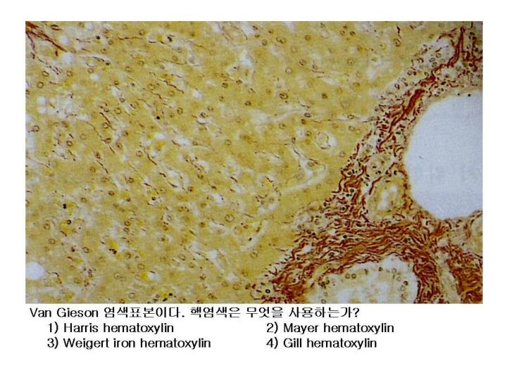 PPT - Section 1-1 Special stain ( 특수염색 ) Connective tissue ( 결합조직 , 결체 ...