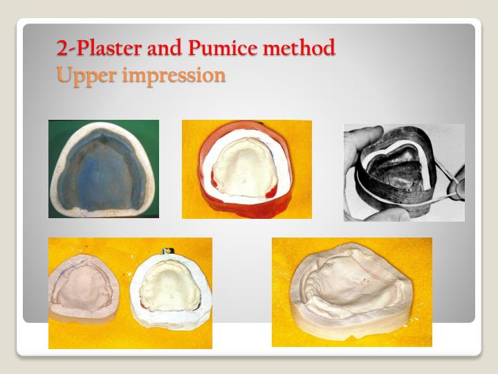 PPT - Impression tray and impression technique PowerPoint Presentation ...