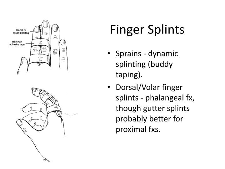 PPT - Splinting Workshop Broward General Medical Center PowerPoint ...