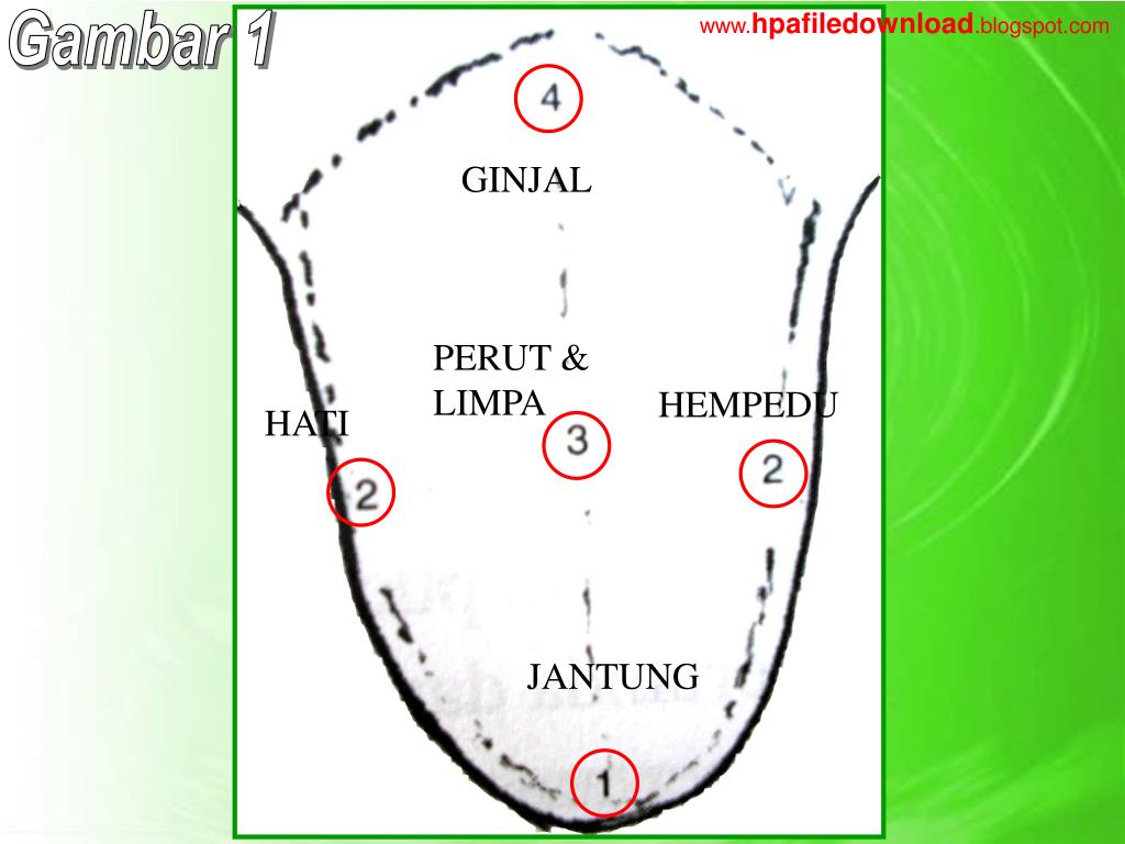 PPT - DIAGNOSA LIDAH PowerPoint Presentation, free download - ID:4295697 PPT - DIAGNOSA LIDAH PowerPoint Presentation, free download - ID:4295697