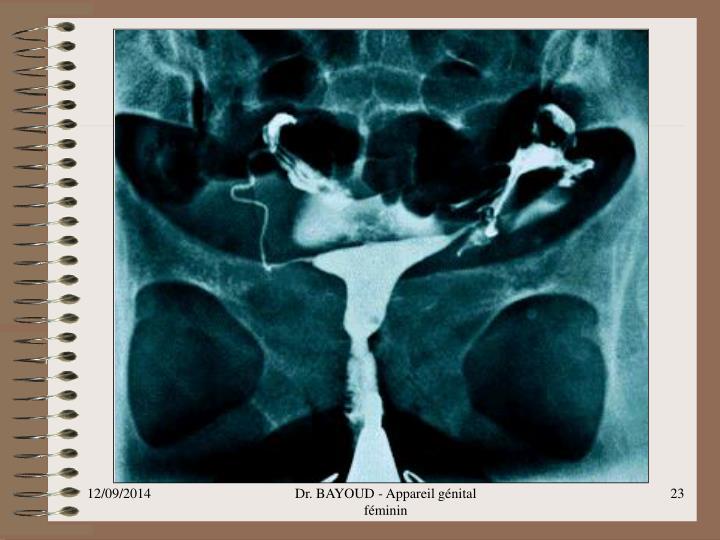 PPT - APPAREIL GENITAL FEMININ PowerPoint Presentation - ID:4303043