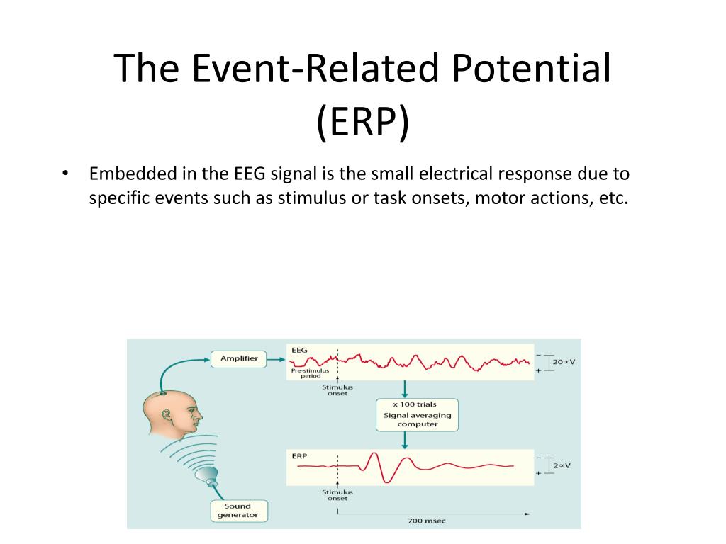 PPT - The Event-Related Potential (ERP) PowerPoint Presentation, free ... PPT - The Event-Related Potential (ERP) PowerPoint Presentation, free ...