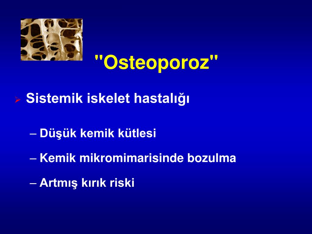 PPT - Osteoporoz Tanı ve Tedavi Prensipleri PowerPoint Presentation ...