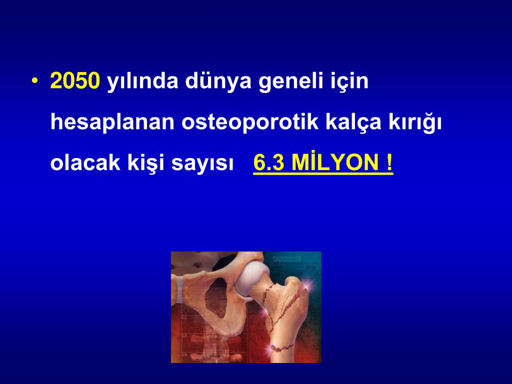 PPT - Osteoporoz Tanı ve Tedavi Prensipleri PowerPoint Presentation ...