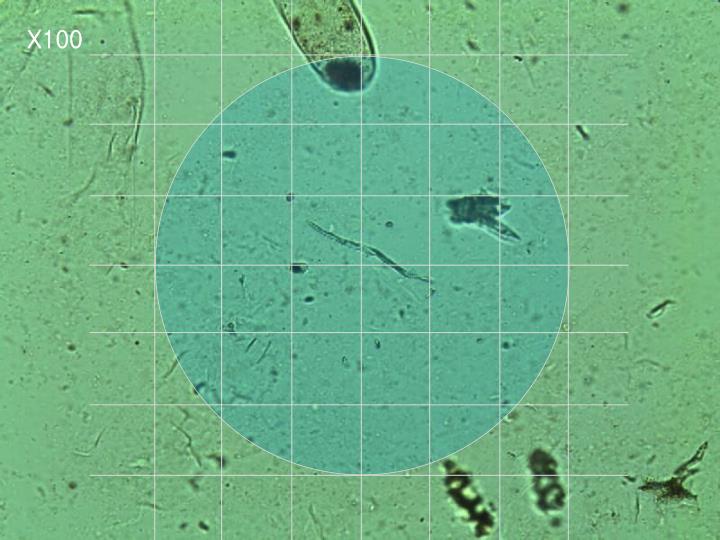 PPT - Howard Mold Counting Method PowerPoint Presentation - ID:4324236